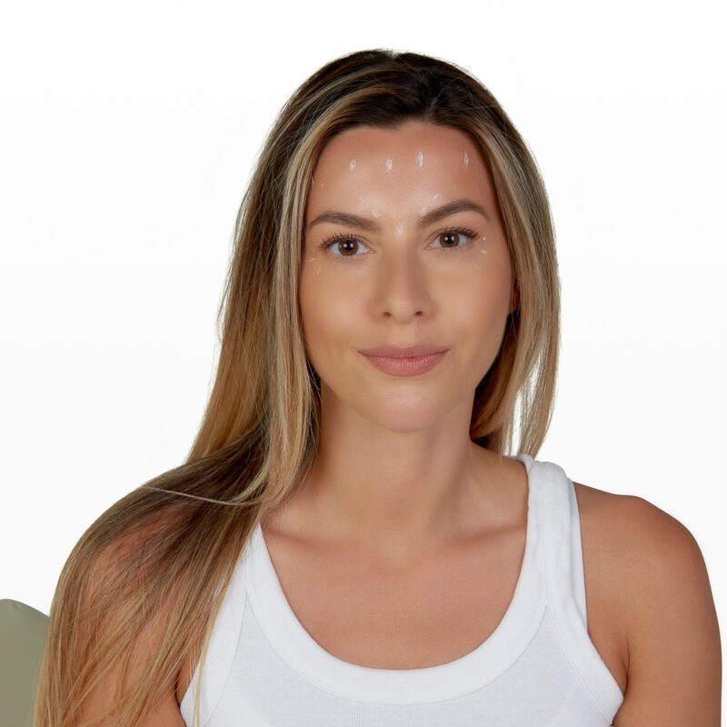 Upper Face - Dr Band Clinic